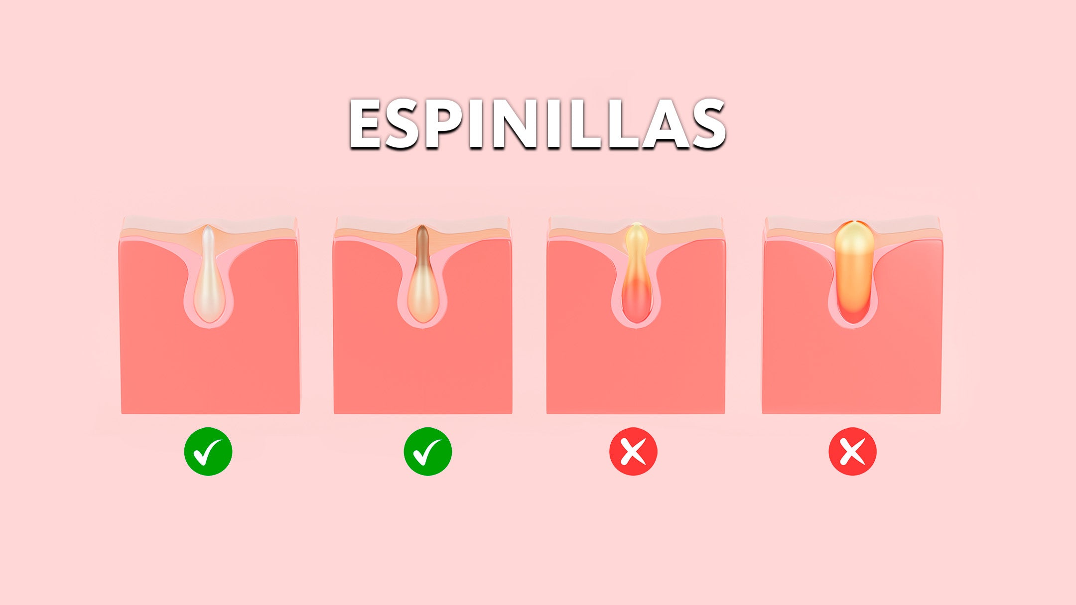 NO TODOS LOS GRANOS SON ESPINILLAS – Cosmetica Fina & Natural®